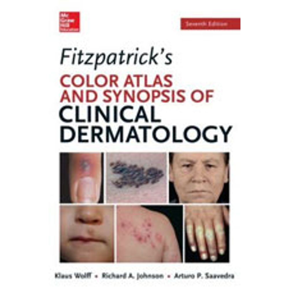 FITZPATRICKS COLOR ATLAS AND SYNOPSIS OF CLINICAL DERMATOLOGY ...